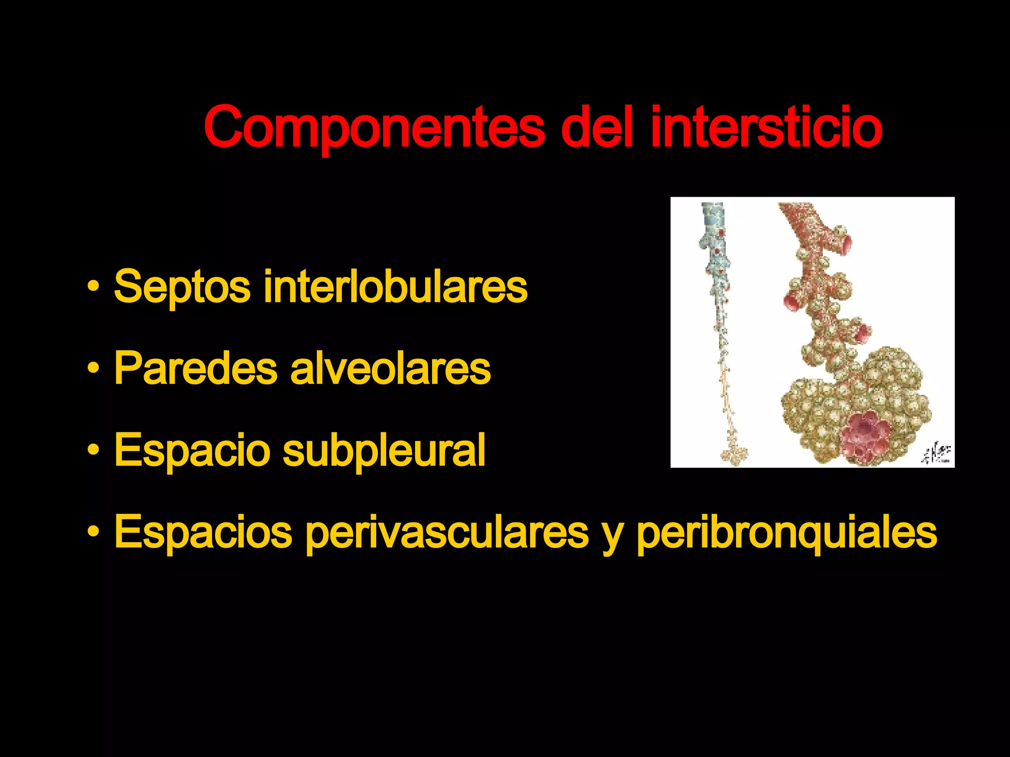 Intersticio pulmonar | PPT