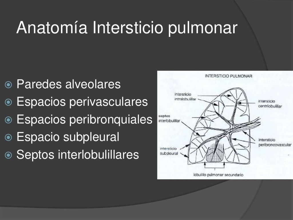 Intersticio pulmonar