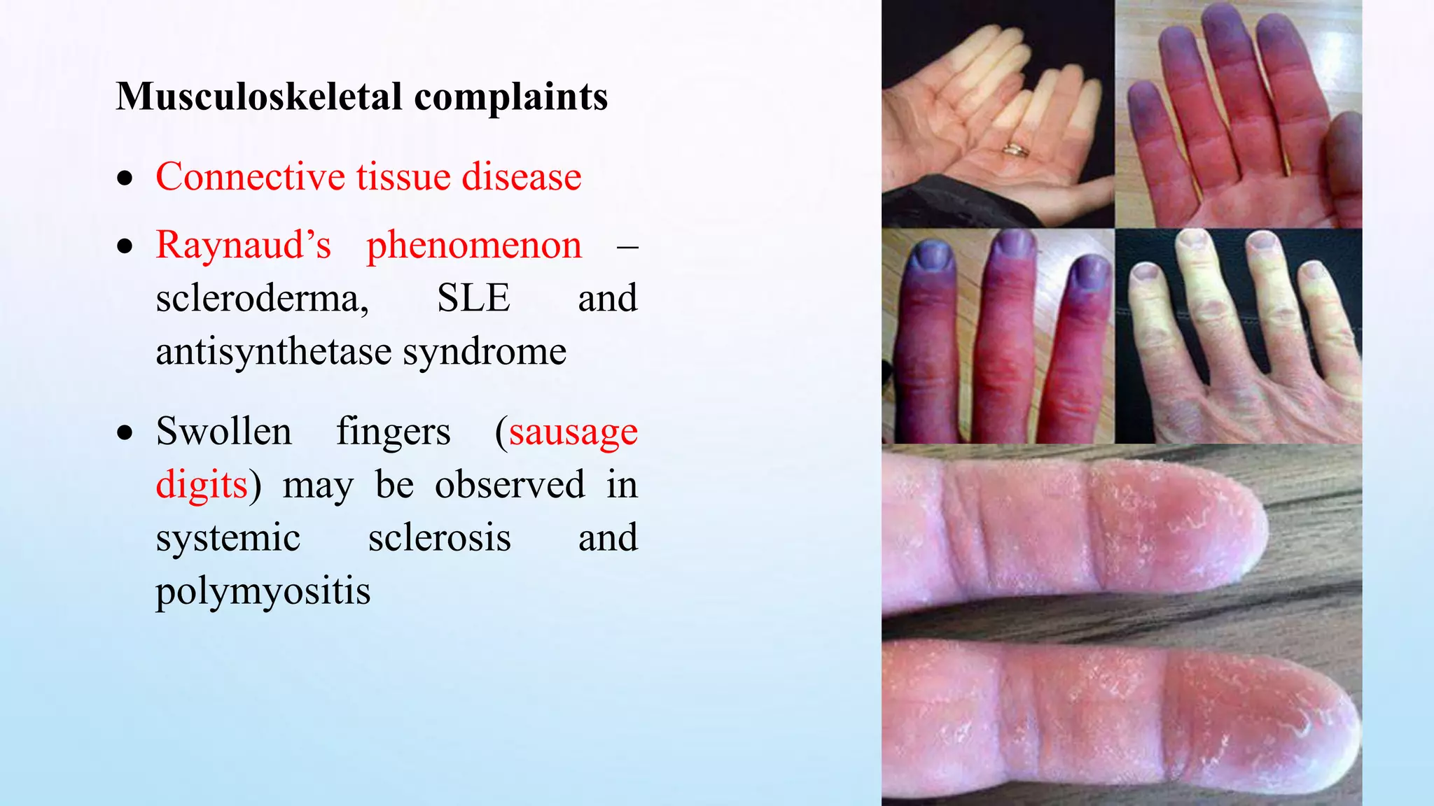 Interstitial lung disease (ILD) ppt slideshare | PPTX