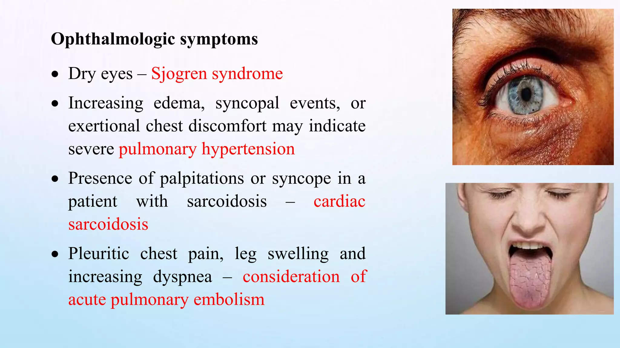 Interstitial lung disease (ILD) ppt slideshare | PPTX