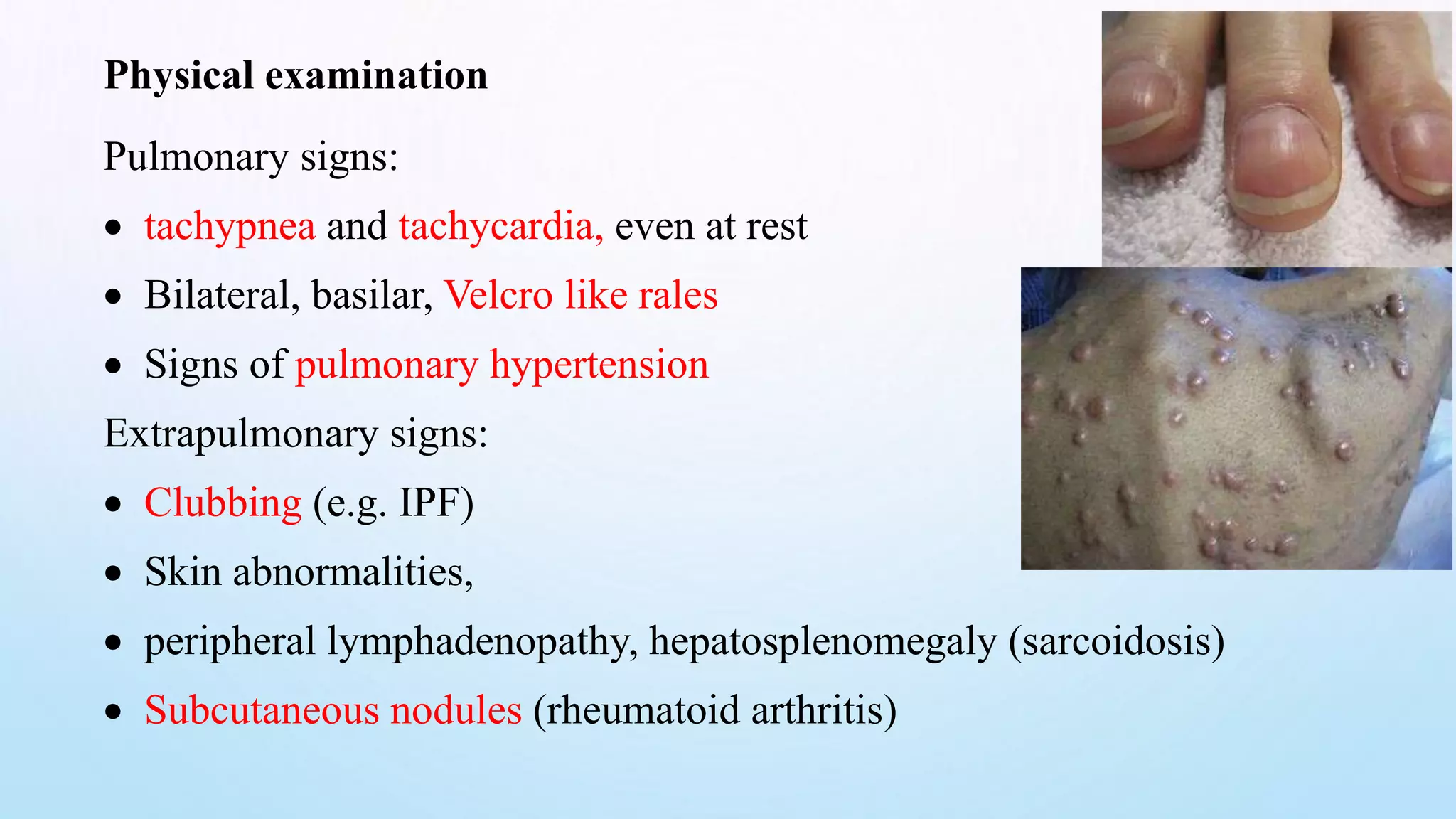 Interstitial lung disease (ILD) ppt slideshare | PPTX