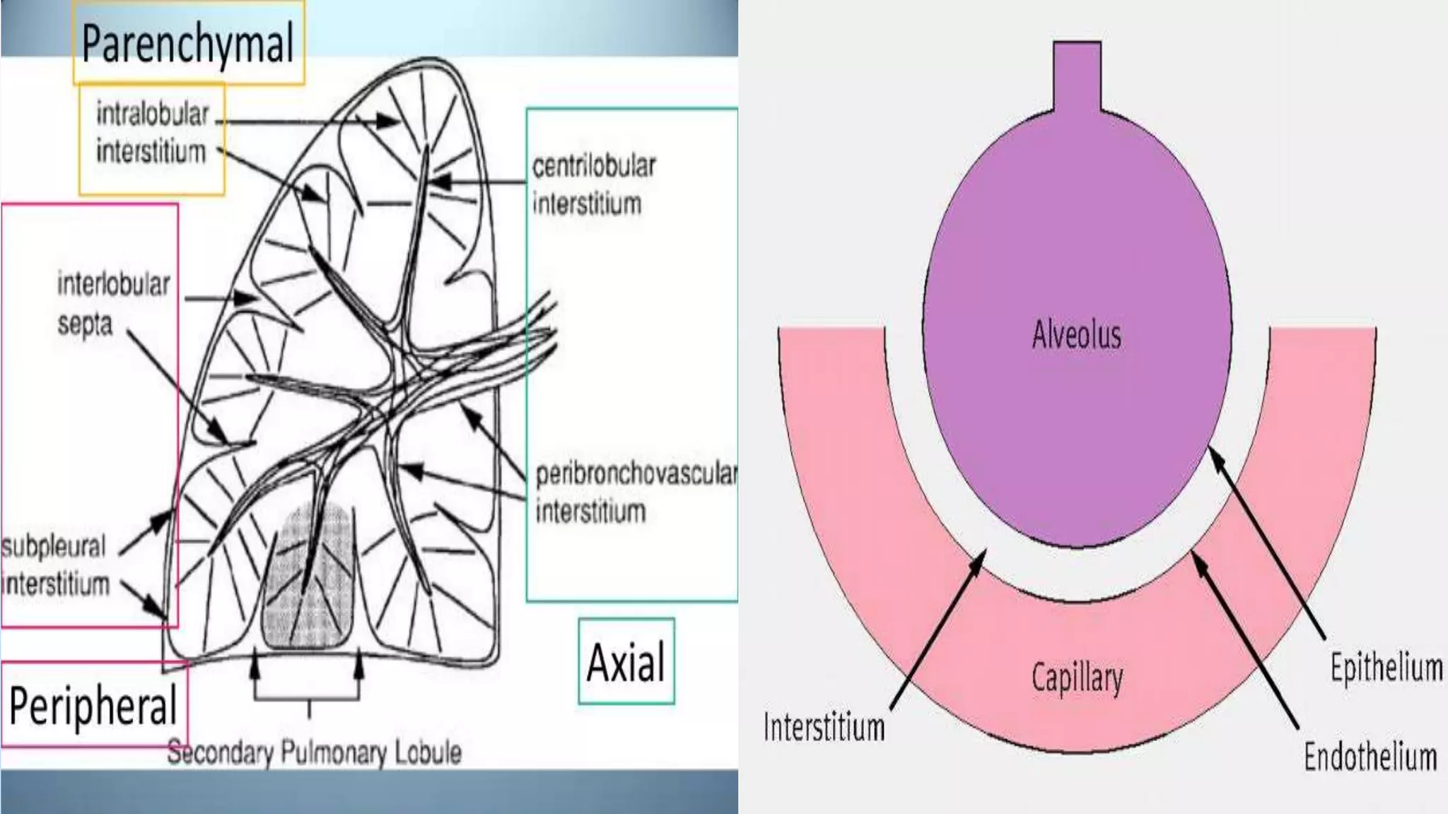 Interstitial lung disease (ILD) ppt slideshare | PPTX