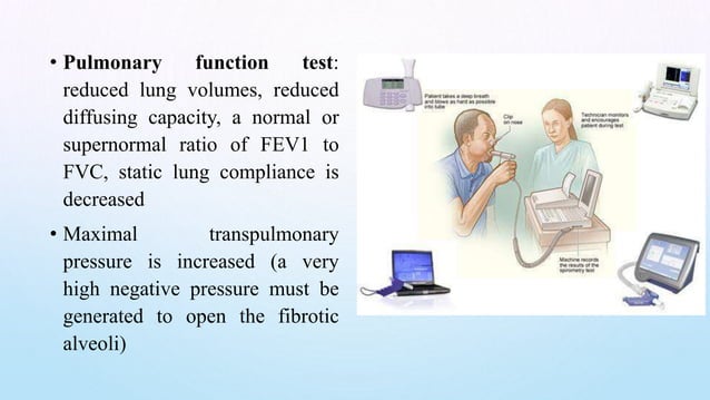 Interstitial lung disease (ILD) ppt slideshare | PPTX | Lung and ...
