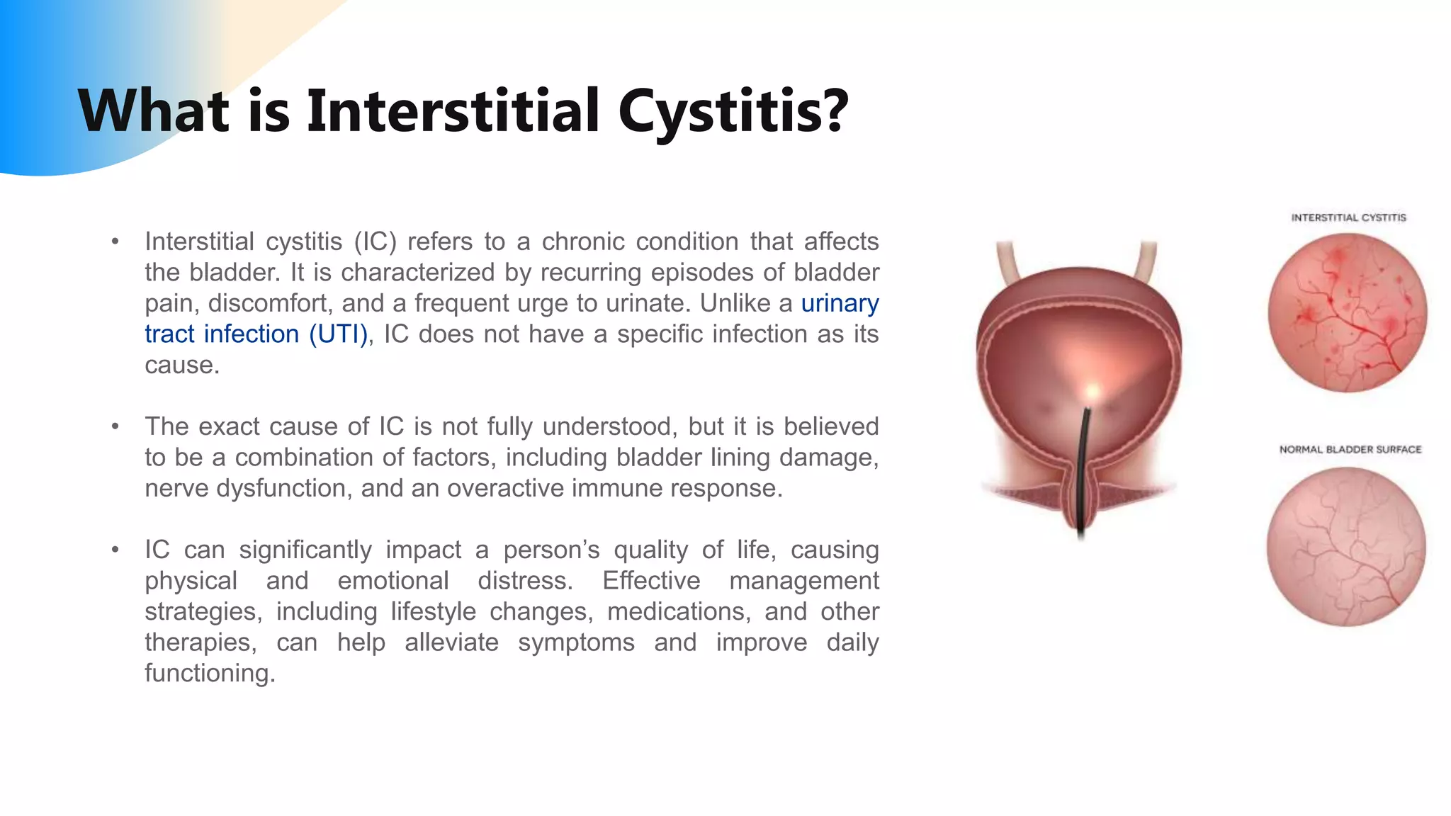 Interstitial Cystitis.pptx | Sexual Conditions | Sexual Health