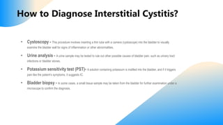 Interstitial Cystitis.pptx | Sexual Conditions | Sexual Health
