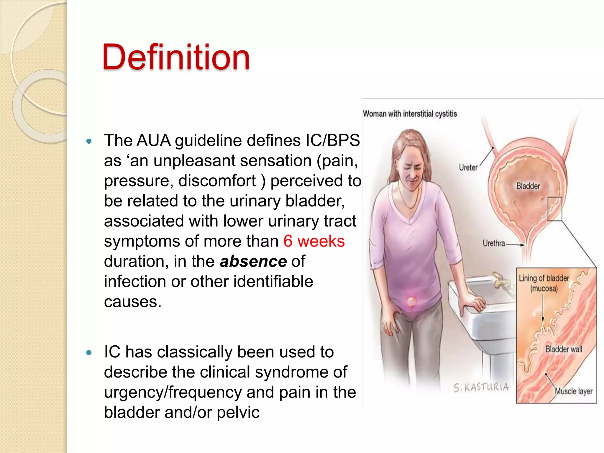 Interstitial cystitis[1] | PPTX