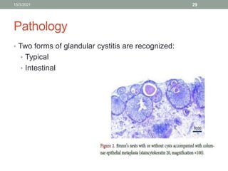 Interstitial cystitis and Cystitis gandularis Finale.pptx | Diseases ...