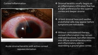 Disciform Keratitis Vs Interstitial Keratitis