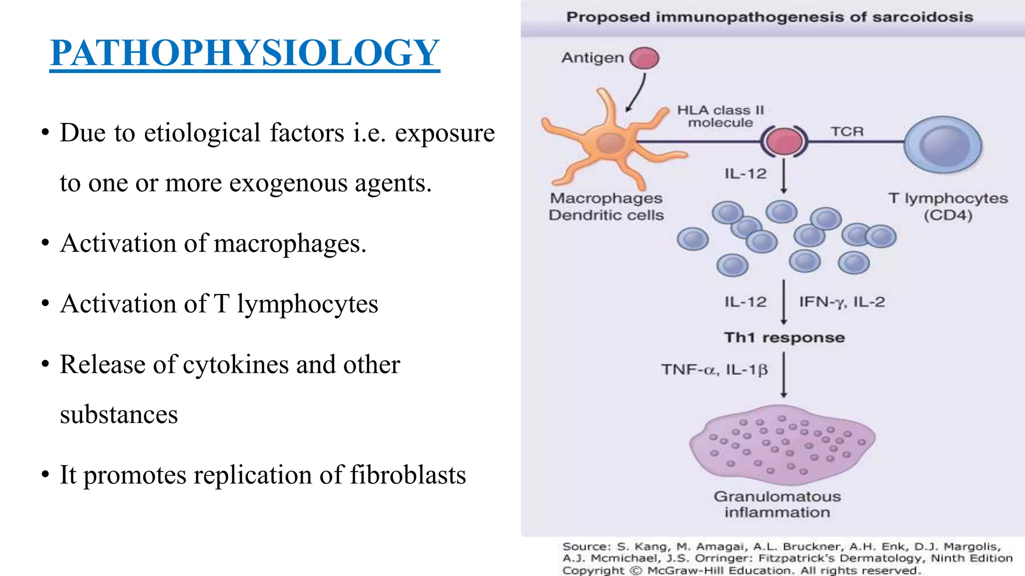 Interstitial lung disease | PPTX