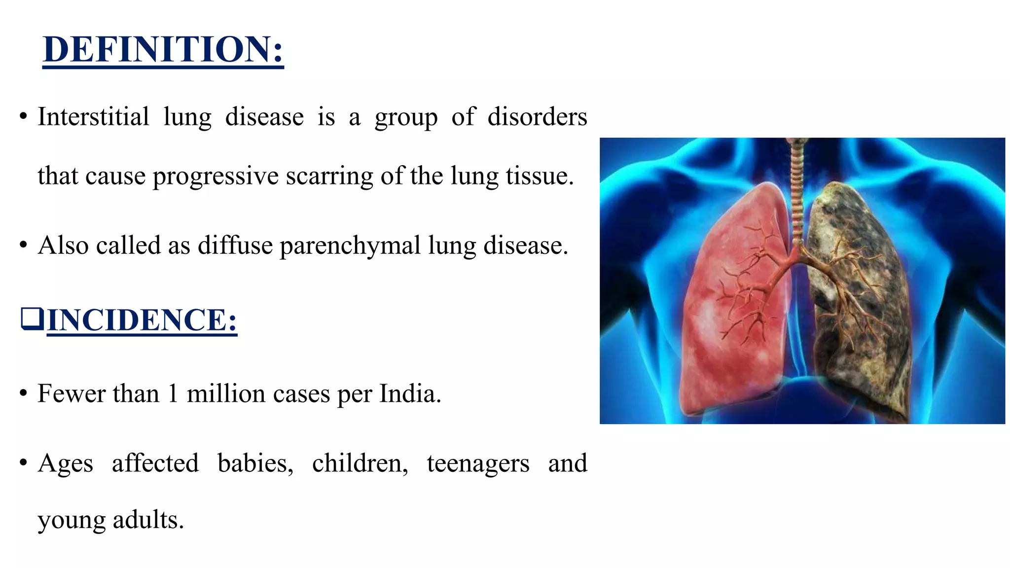 Interstitial lung disease | PPTX