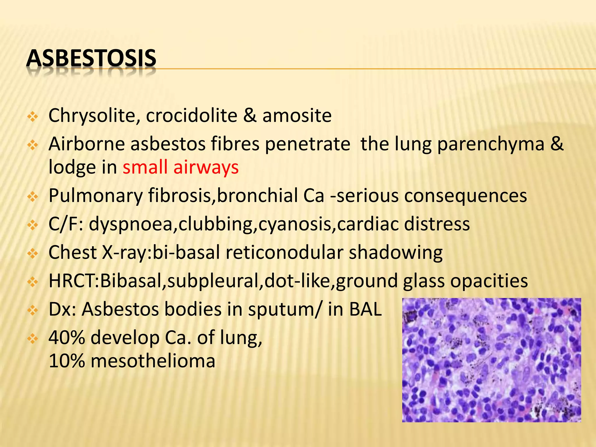 Interstitial lung disease.pptx