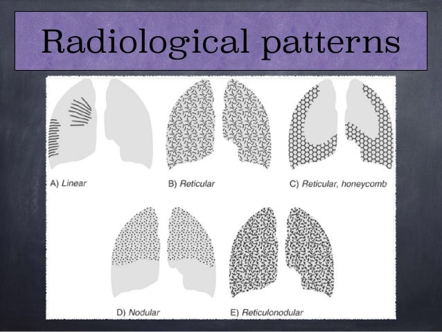 Practical Approach To Interstitial Lung Diseases