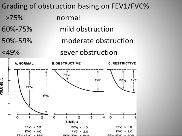 PFT and Interstitial lung diseases