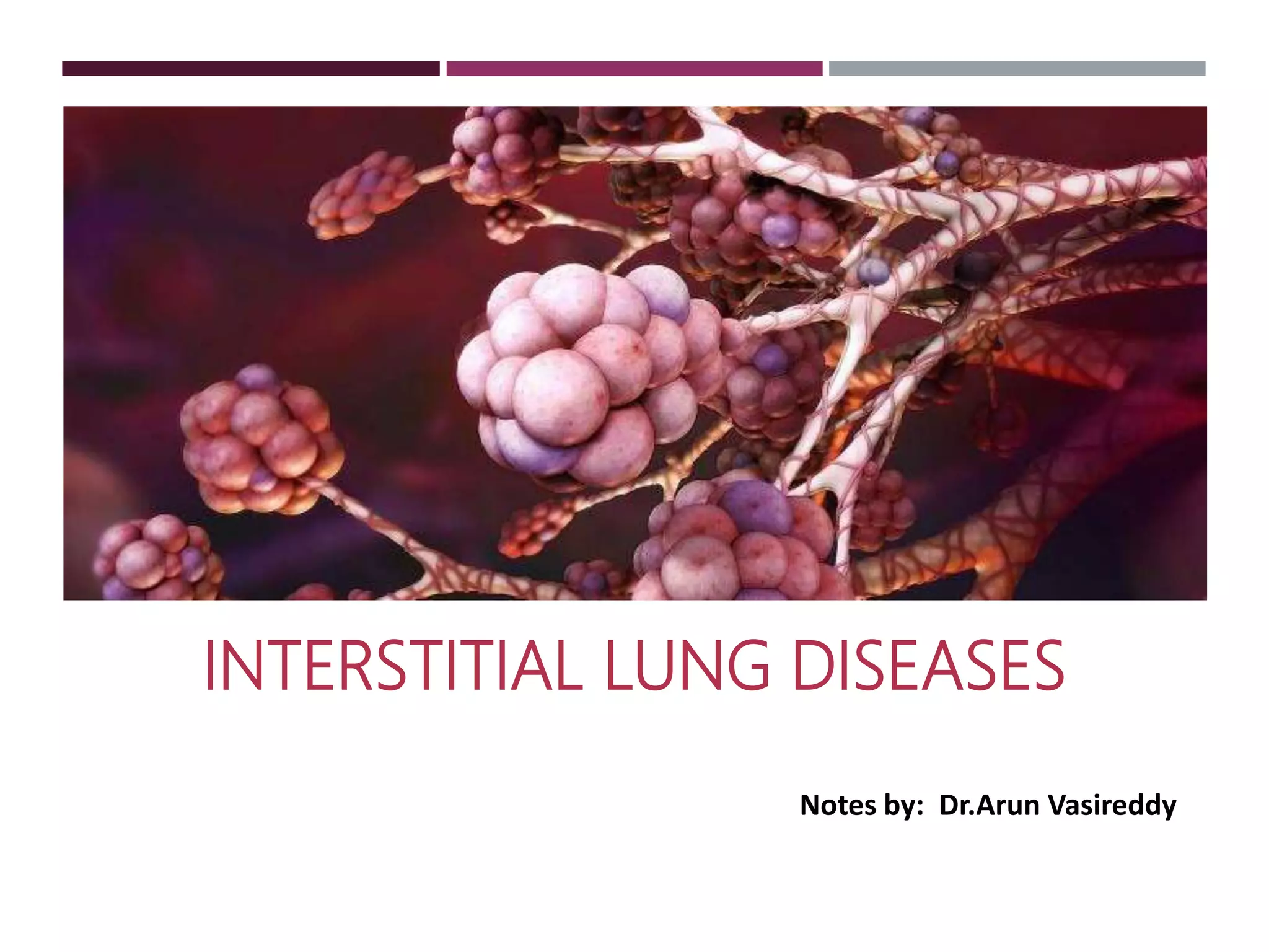 Interstitial Lung Diseases [ILD] Approach to Management | PPTX