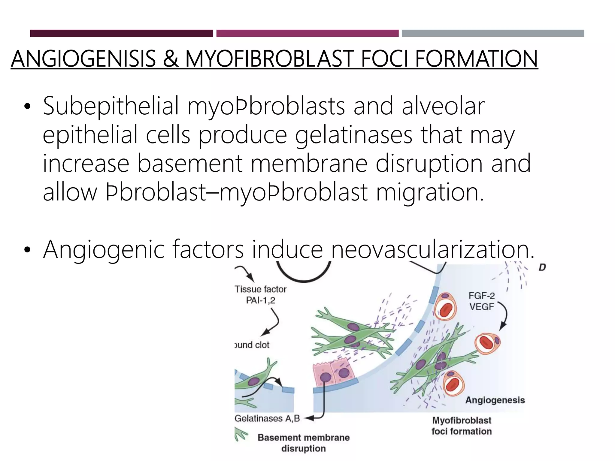Interstitial Lung Diseases [ILD] Approach to Management | PPTX