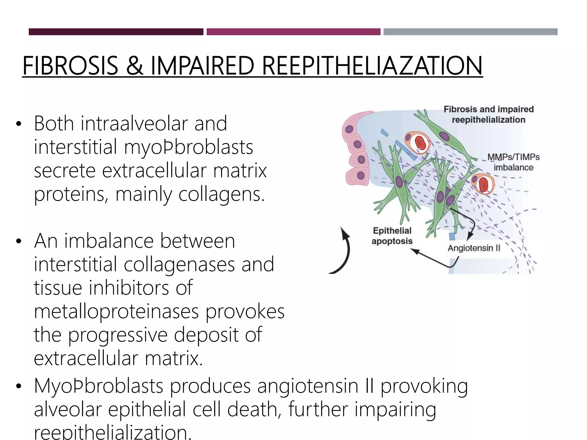 Interstitial Lung Diseases [ILD] Approach to Management | PPTX