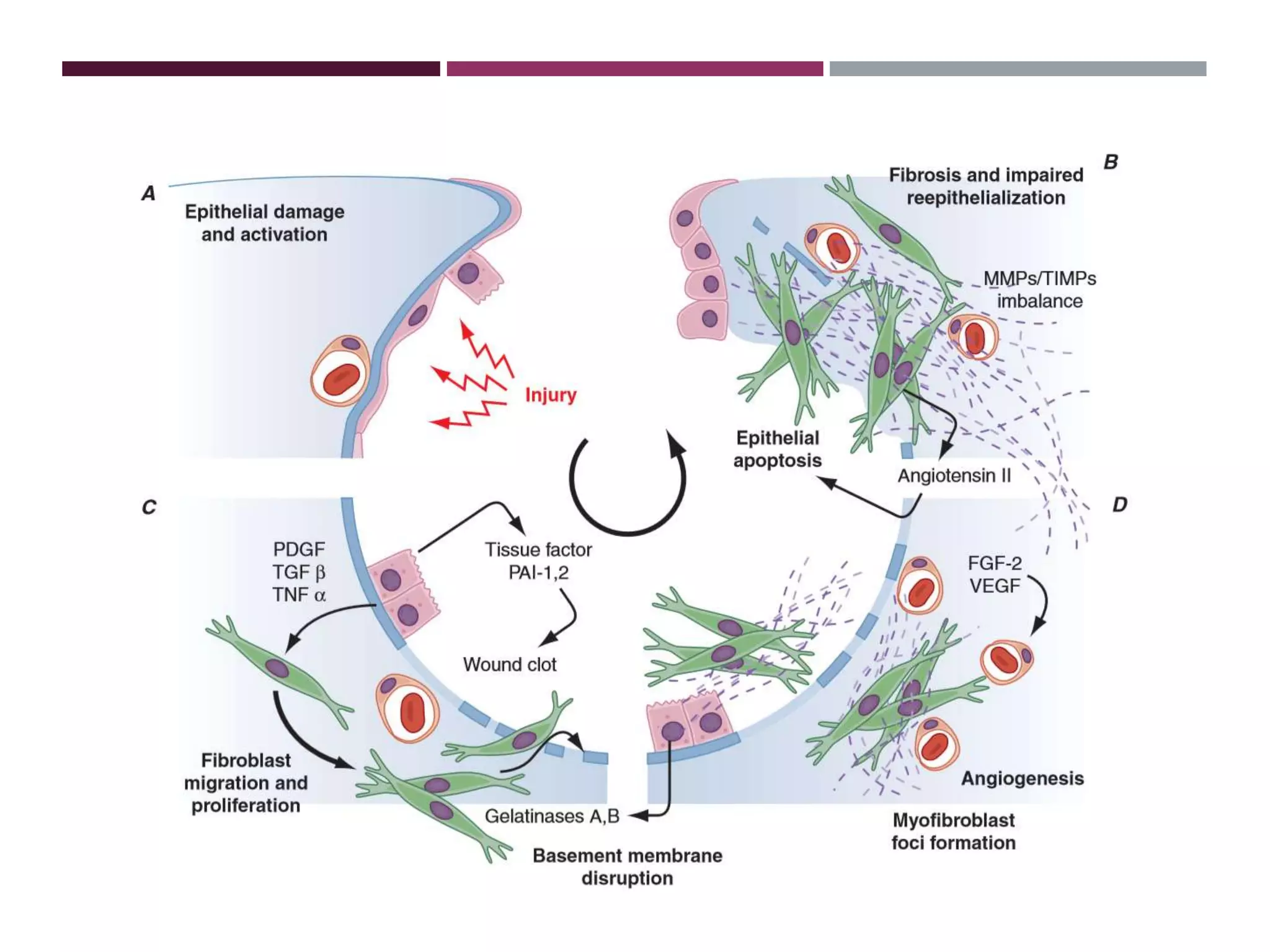 Interstitial Lung Diseases [ILD] Approach to Management | PPTX