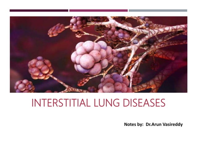 Interstitial Lung Diseases [ILD] Approach to Management | PPTX