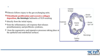 Interstitial Lung Diseases ILD Michael.pptx