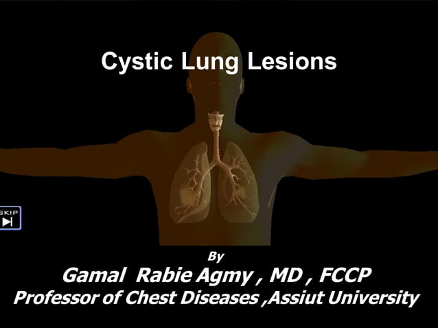 Diffuse parenchymal lung diseases (Postgraduate course) | PDF | Lung ...