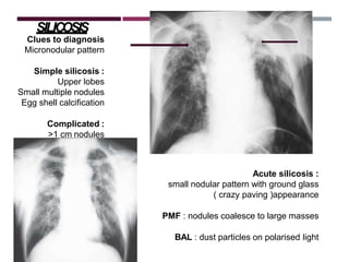 Interstitial lung fibrosis diseases | PPTX