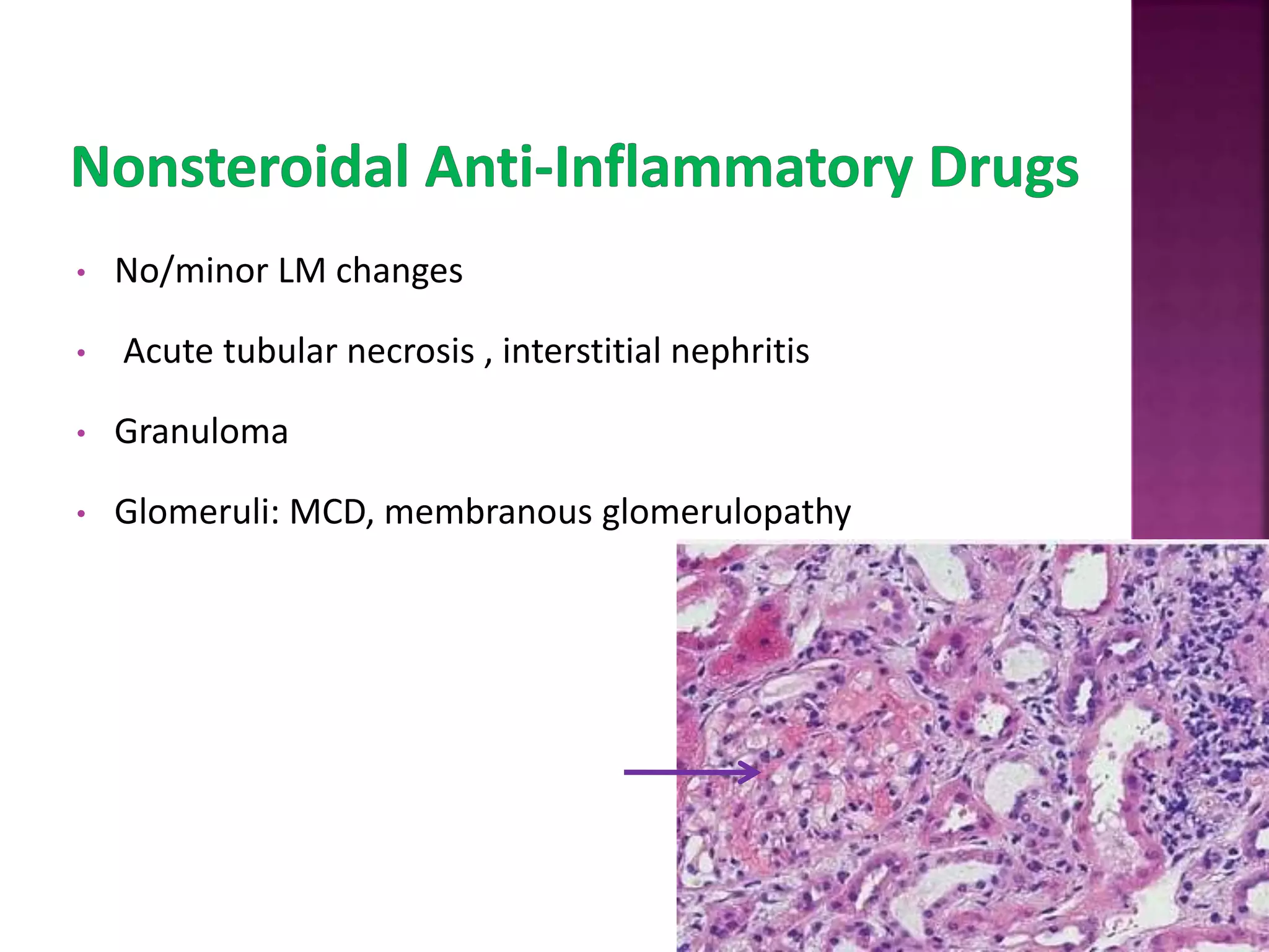 Interstitial nephritis, pyelonephritis and other renal infections | PPT