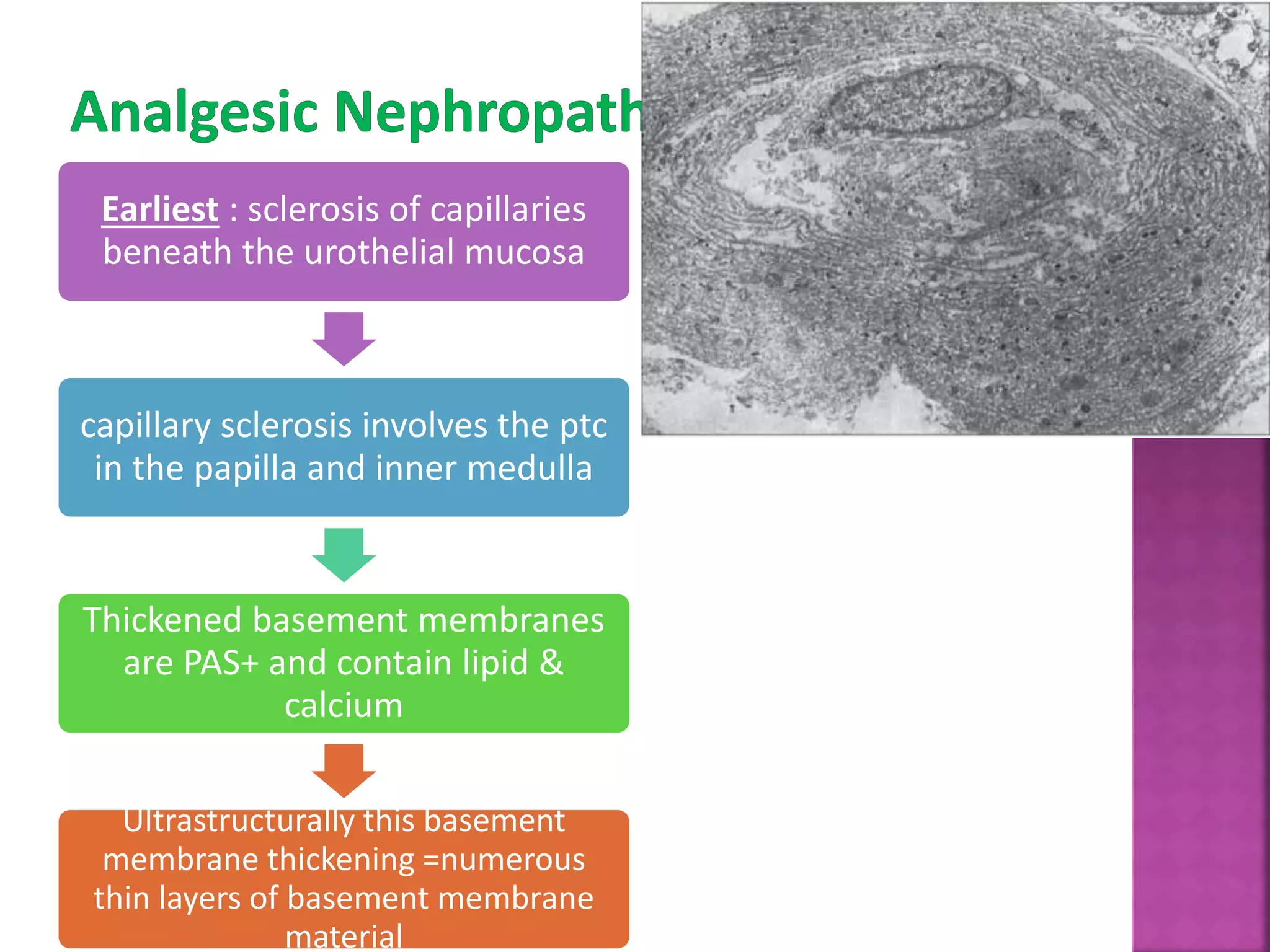 Interstitial nephritis, pyelonephritis and other renal infections | PPTX
