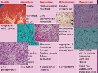Interstitial nephritis, pyelonephritis and other renal infections | PPTX