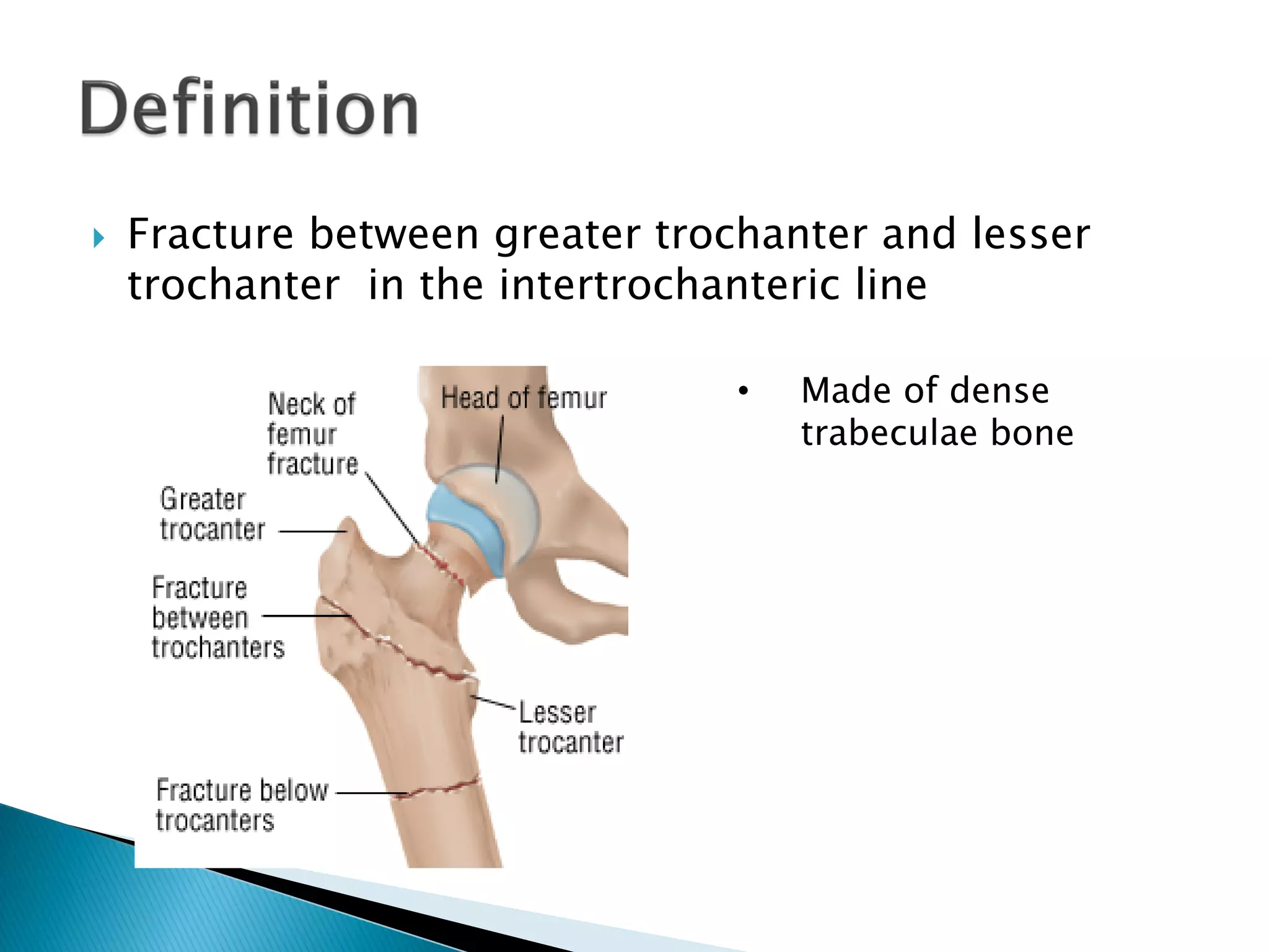 Intertrochanteric fracture (2) | PDF
