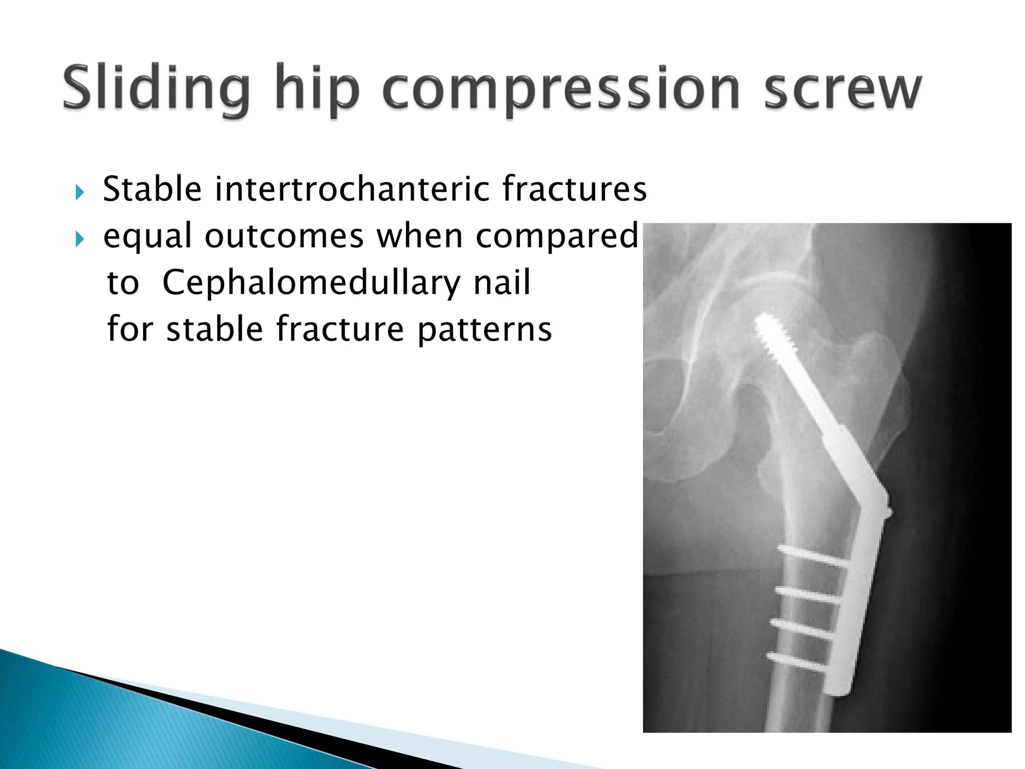 Intertrochanteric fracture (2) | PDF