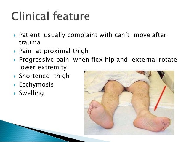 Intertrochanteric fracture (2)