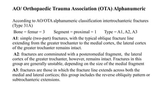 Comprehensive Overview of Intertrochanteric Femur Fractures: Diagnosis ...