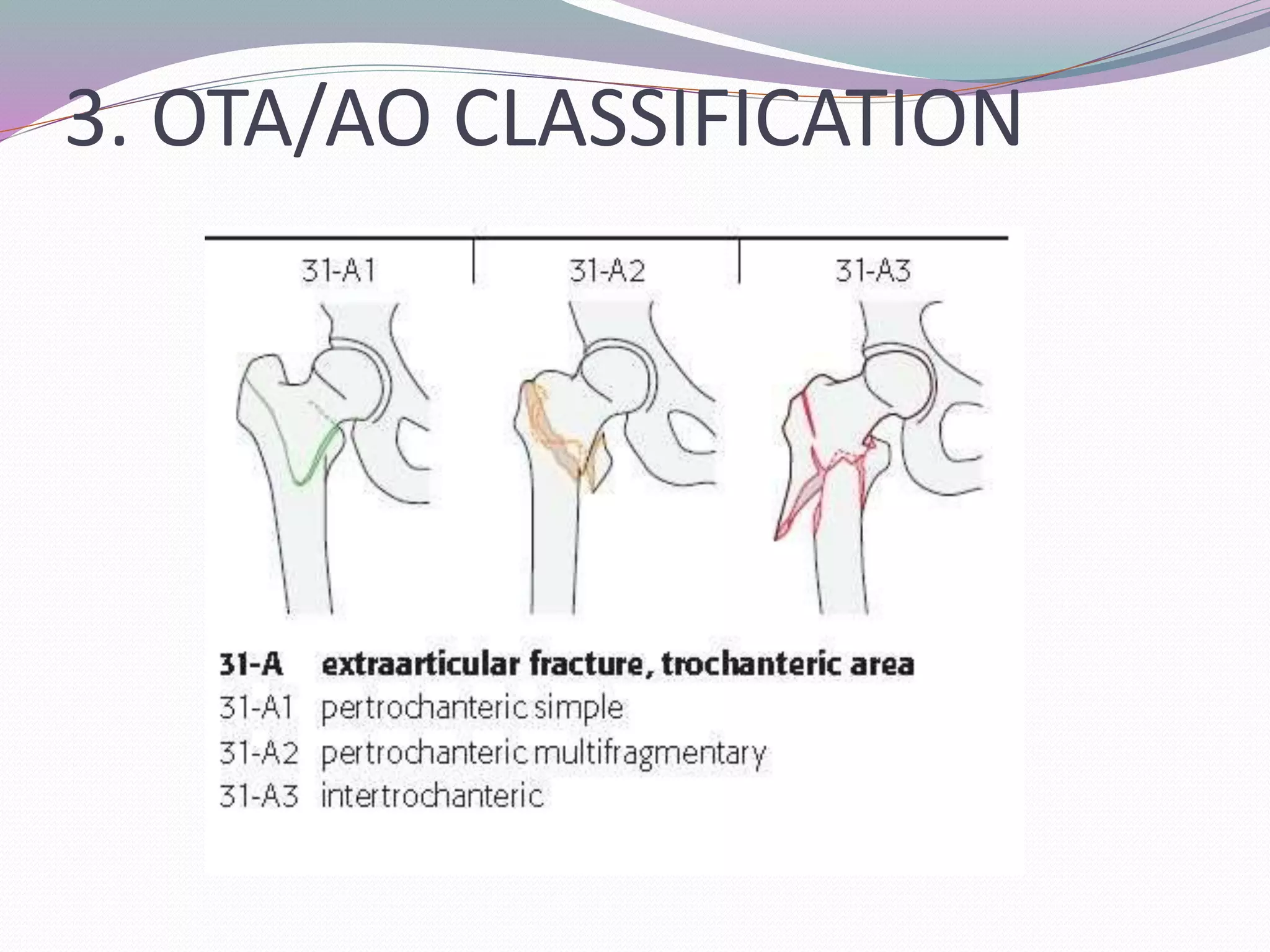 Intertrochanteric fracture femur | PPTX