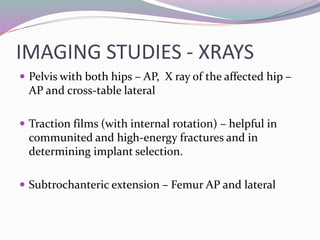 Intertrochanteric fracture femur | PPTX