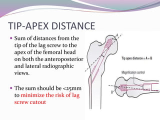 Intertrochanteric fracture femur | PPT