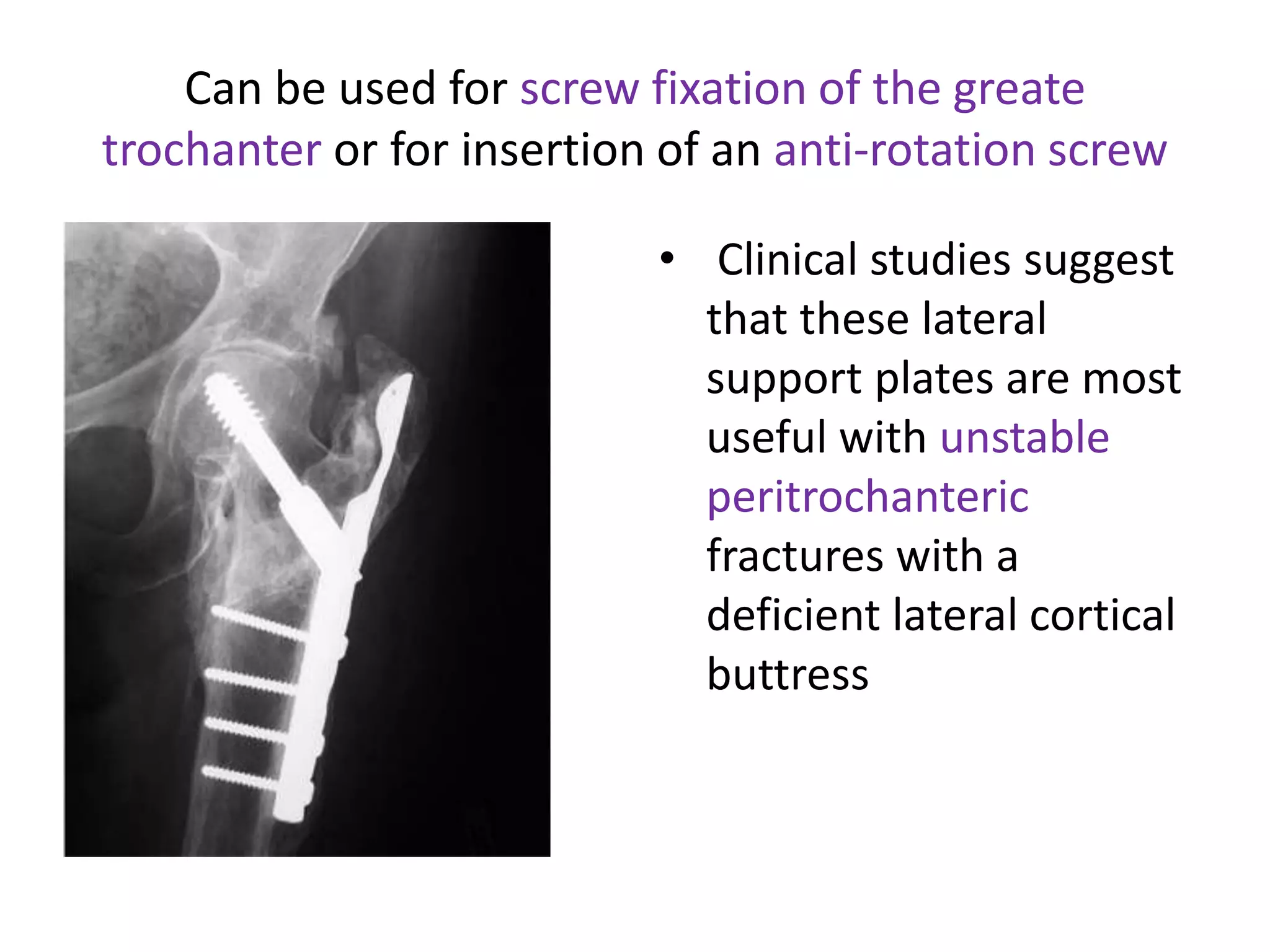 Intertrochanteric fractures / hip fracture | PPTX