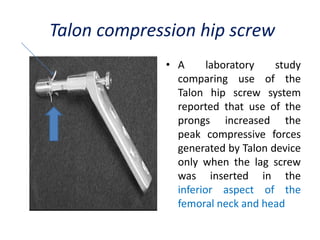 Intertrochanteric fractures / hip fracture | PPTX