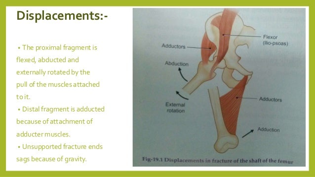 External Rotation Of Leg