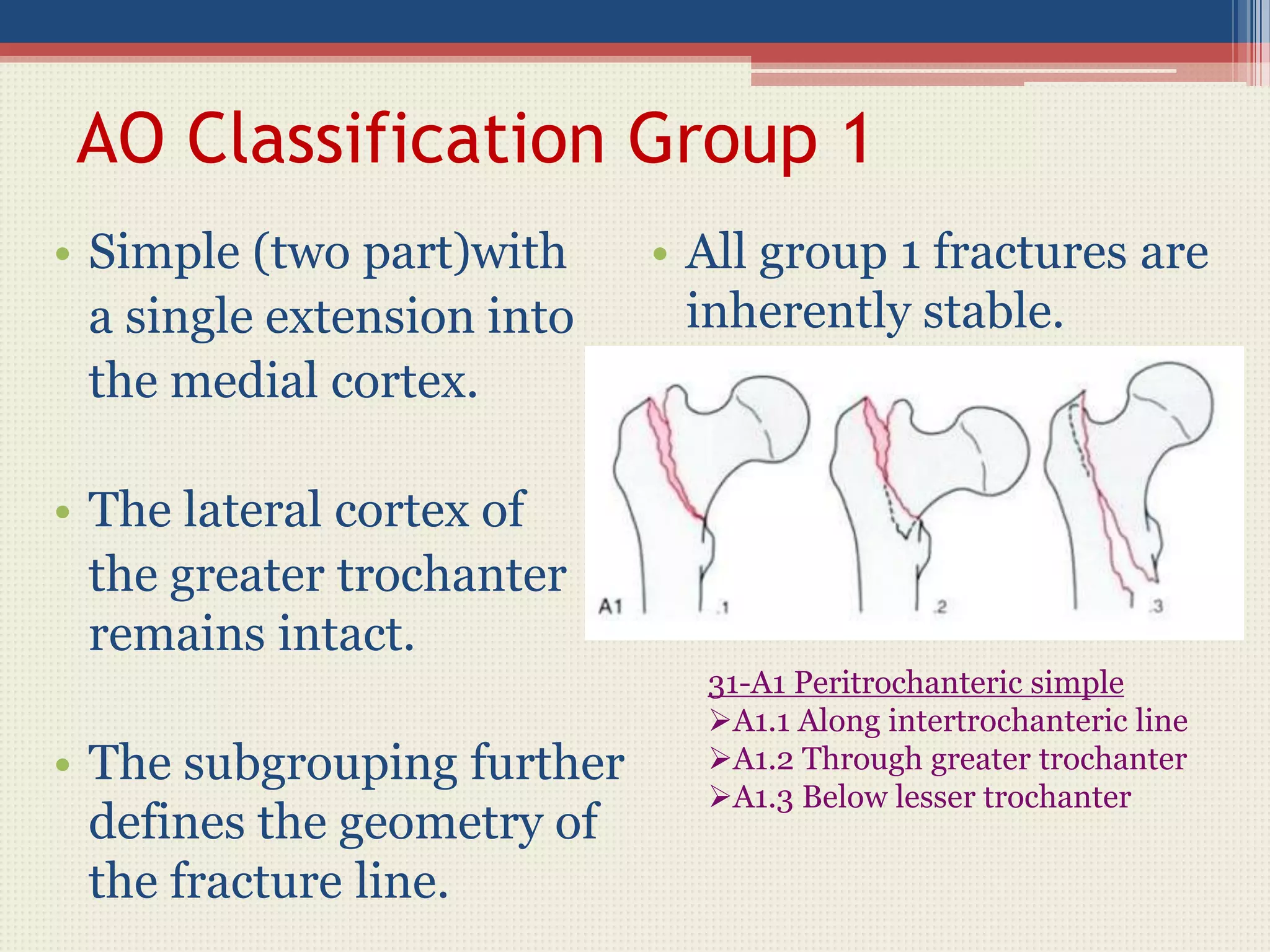 Intertrochanteric fractures and its management with DHS or PFN or ...