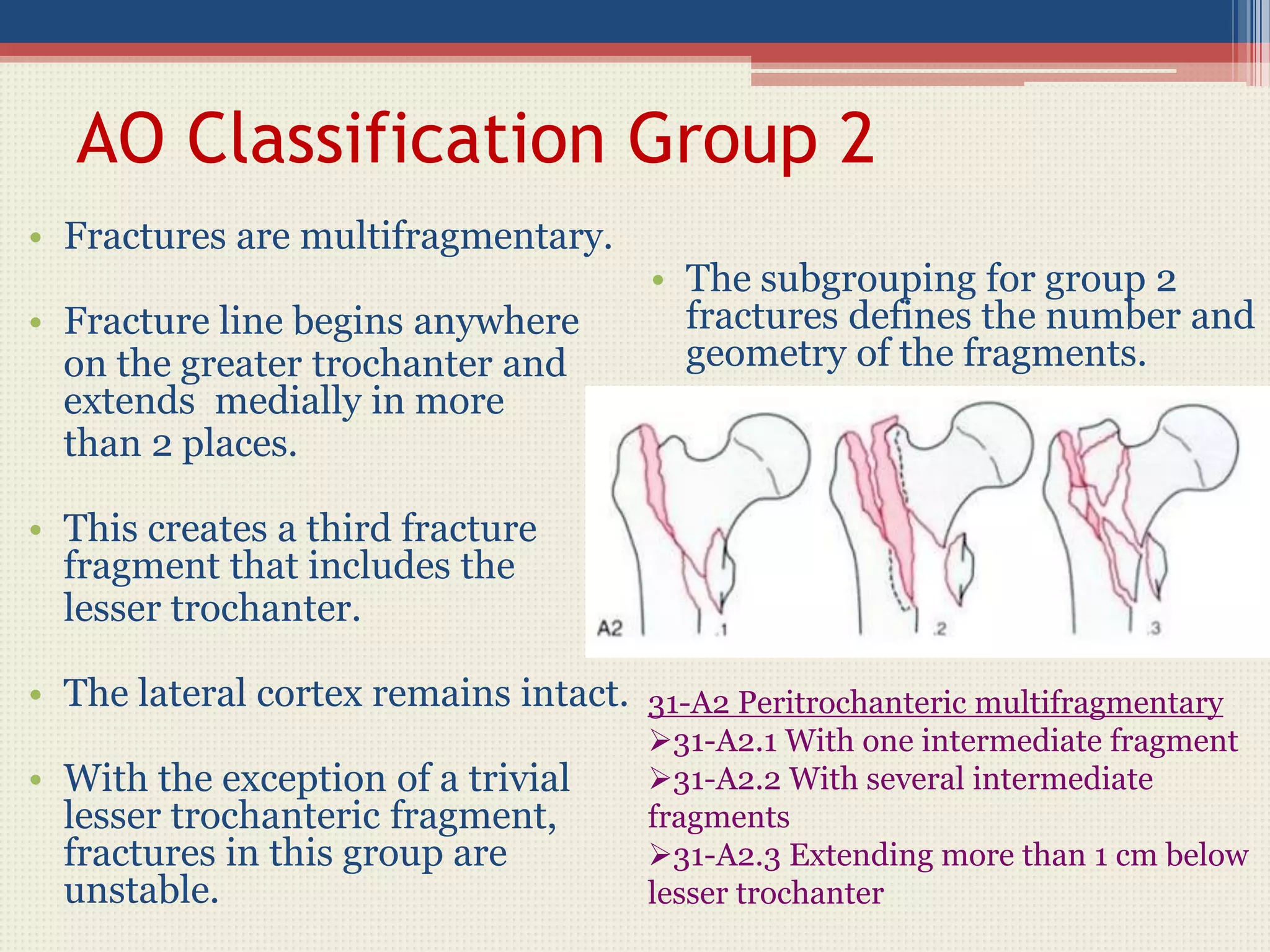 Intertrochanteric fractures and its management with DHS or PFN or ...