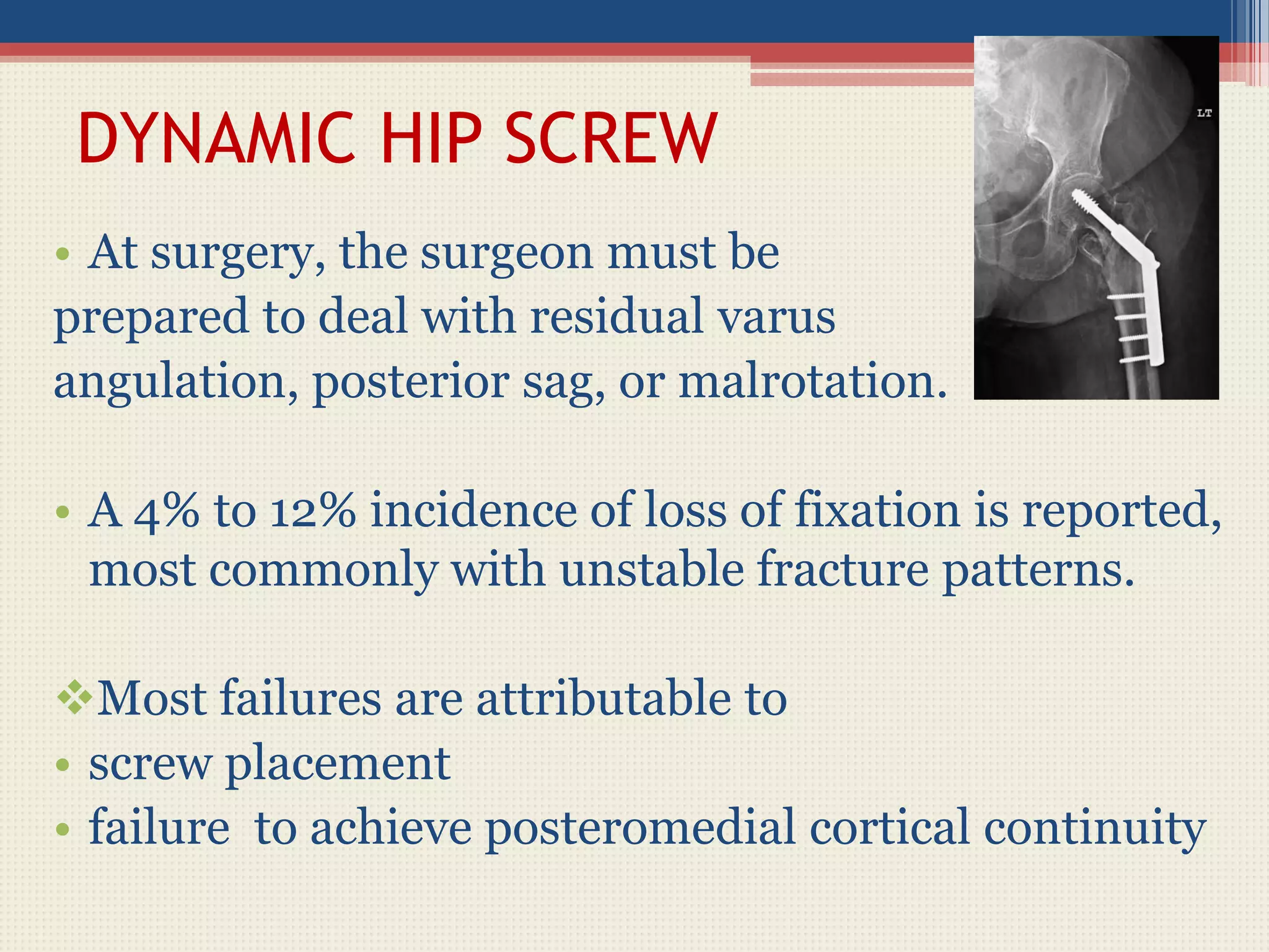 Intertrochanteric fractures and its management with DHS or PFN or ...