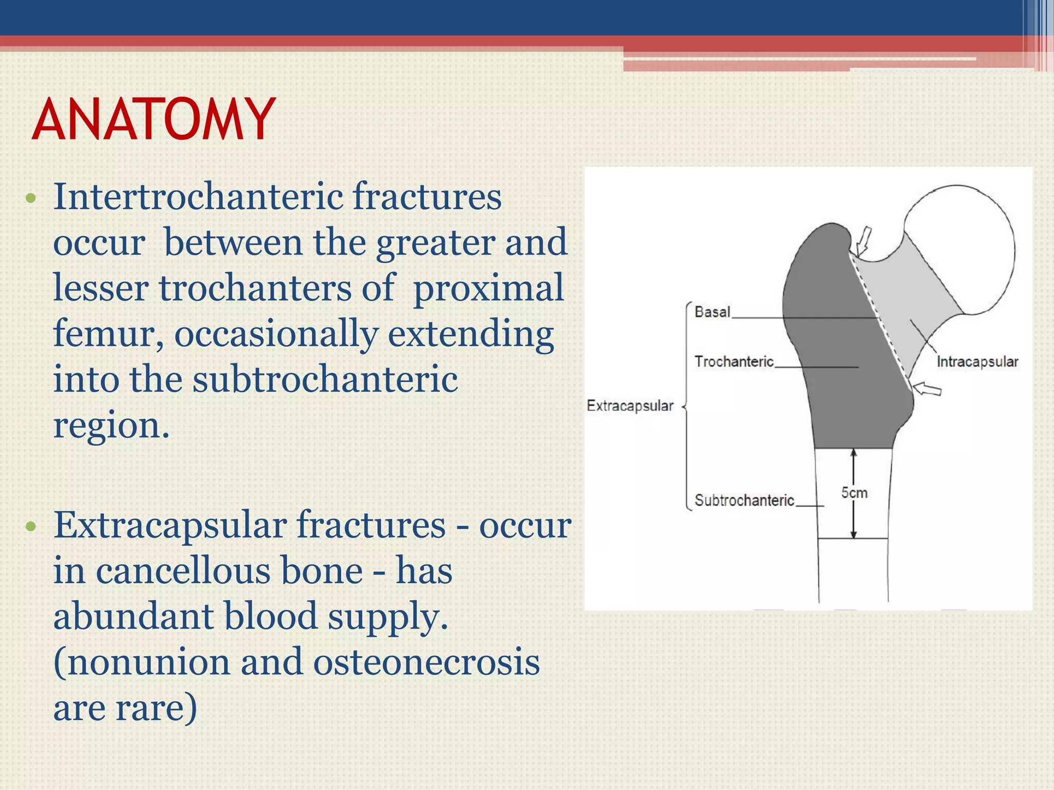 Intertrochanteric fractures and its management with DHS or PFN or Arthroplasty - Dr Kota Aditya ...