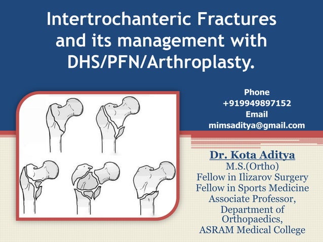 Intertrochanteric fractures and its management with DHS or PFN or ...