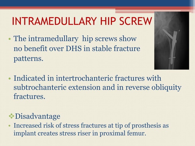 Intertrochanteric fractures and its management with DHS or PFN or ...