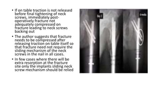 Intertrochanteric Fractures: Ten Commandments for How to Get Good ...