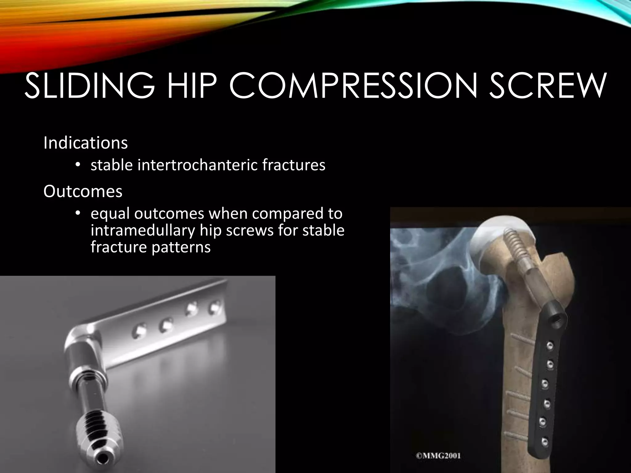 InterTrochanteric Fractures | PPTX