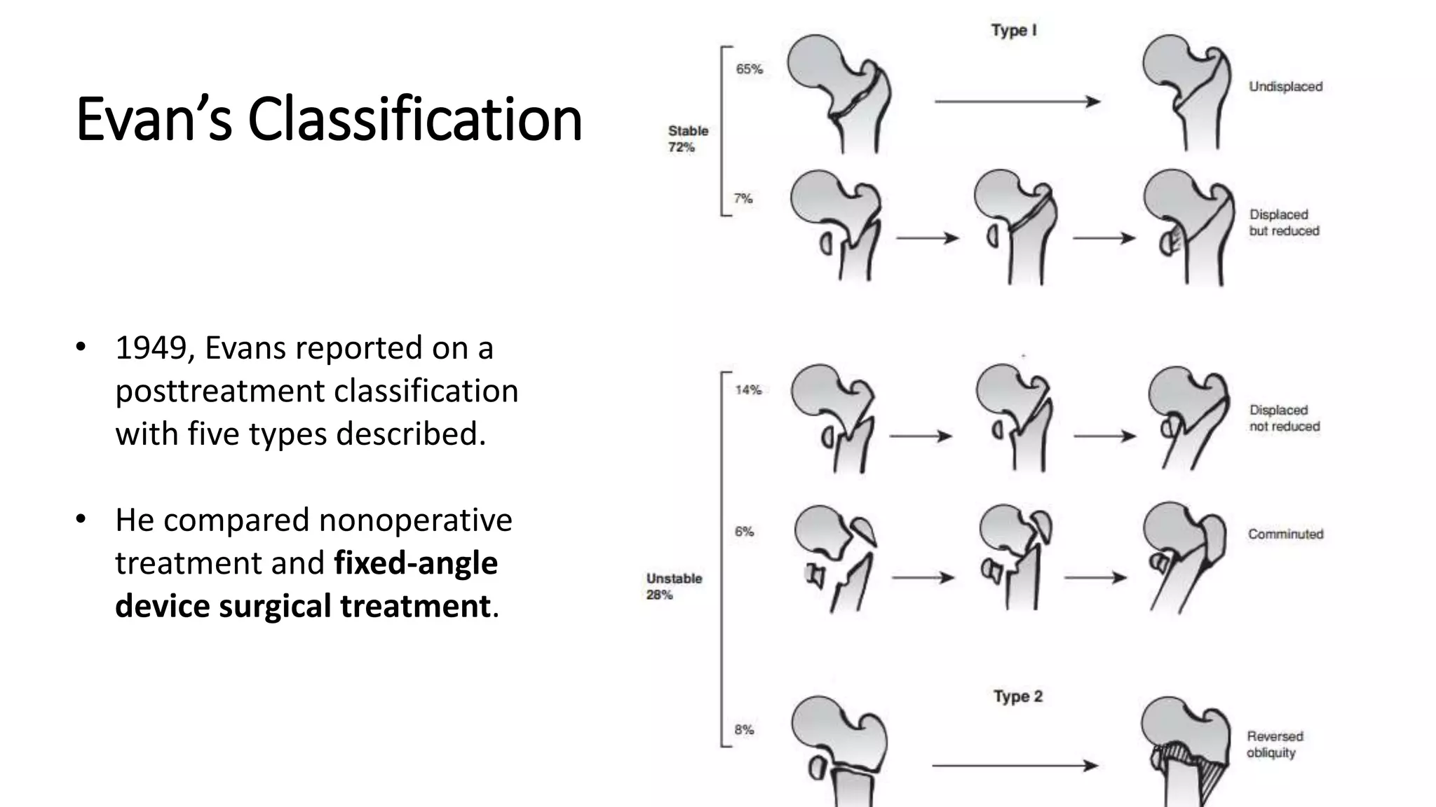 Intertrochanteric Fractures of Femur | PPTX