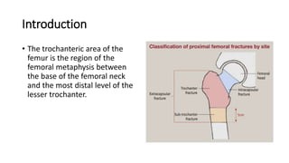 Intertrochanteric Fractures of Femur | PPTX