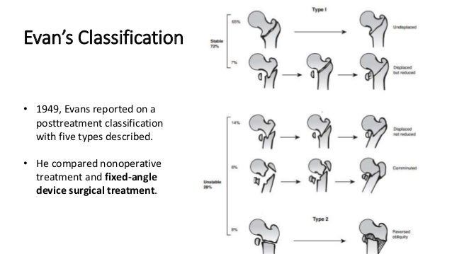 Intertrochanteric Fractures of Femur