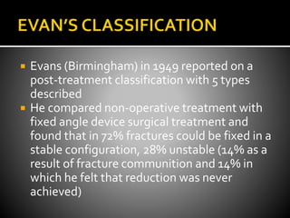 Evans Hip Fracture Classification